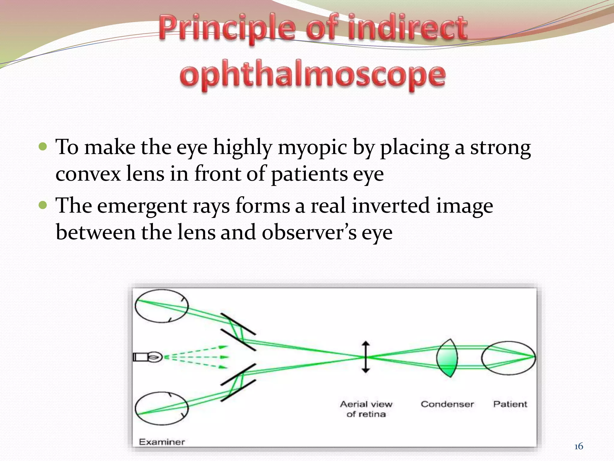 Binocular Indirect OPHTHALMOSCOPY | PPTX