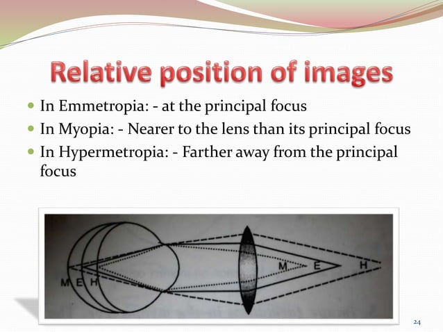 Binocular Indirect Ophthalmoscopy | PPTX