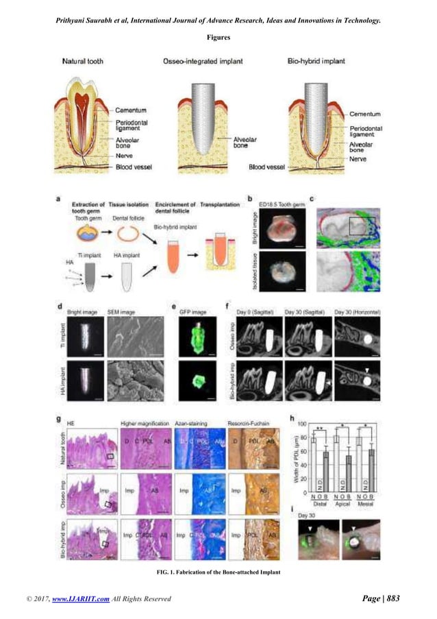 Bio Hybrid The Next Gen Implant Pdf