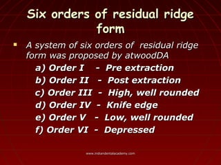 Bio mechanical considerations in complete denture prosthesis-cha/dental ...