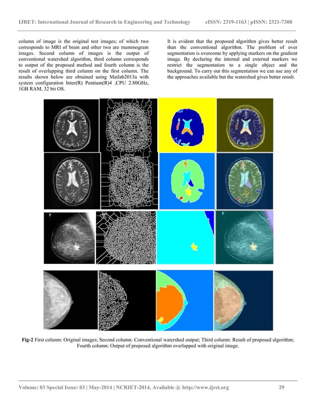 Bio medical image segmentation using marker controlled watershed algorithm a case study | PDF