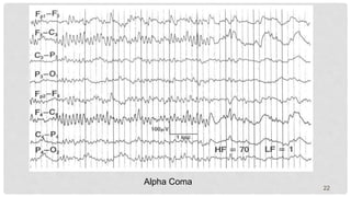 Bio medical signal analysis(both normal and abnormal) | PPTX