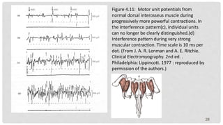 Bio medical signal analysis(both normal and abnormal) | PPTX