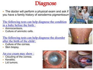 Xeroderma pigmentosum | PPTX