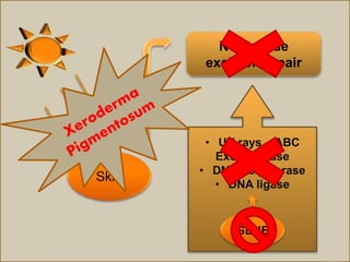 Xeroderma pigmentosum | PPTX