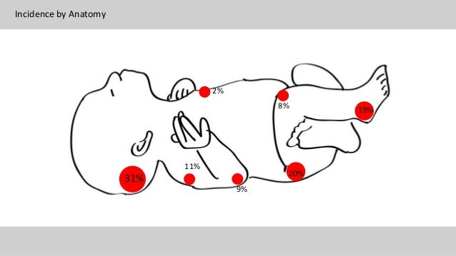 How might we prevent occipital pressure ulcers in pediatric patients