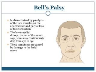 Bio 161 _lab__9_cranial_nerves | PPT