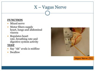 Bio 161 _lab__9_cranial_nerves | PPT