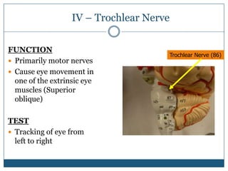 Bio 161 _lab__9_cranial_nerves | PPT