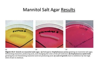 Bio235_ Exe.13 Special Media for isolating bacteria_Fall 19.pptx