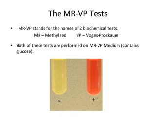 Bio235_Exe.15 Fermentation_Fall19.pptx