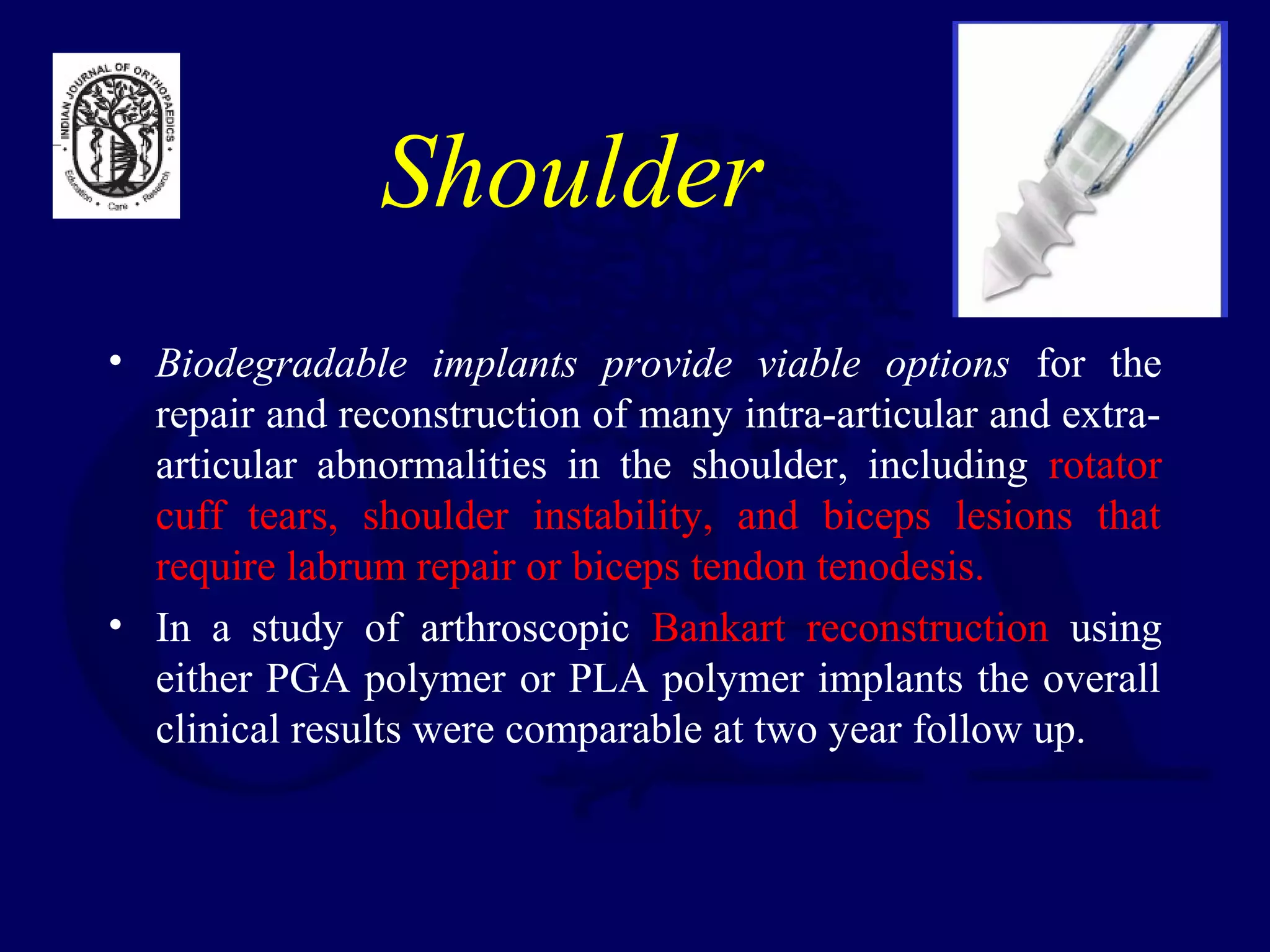Bioabsorbable Implants in Orthopaedics - Dr Chintan N Patel | PPT