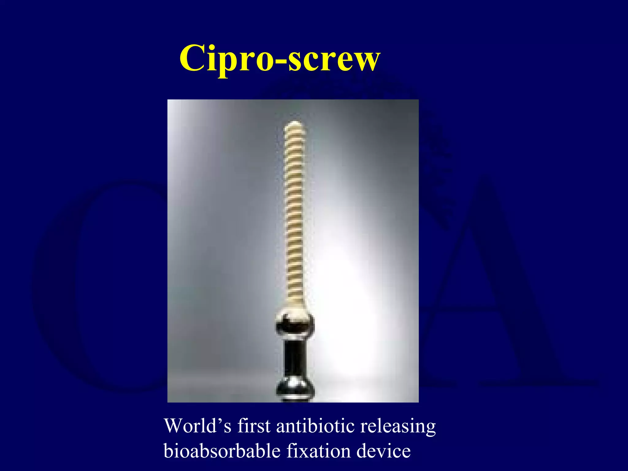 Bioabsorbable Implants in Orthopaedics - Dr Chintan N Patel | PPT