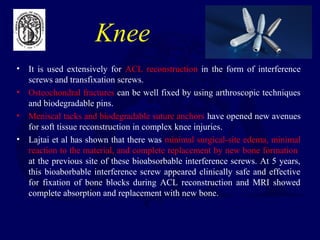 Bioabsorbable Implants in Orthopaedics - Dr Chintan N Patel | PPT