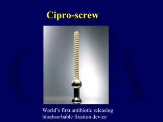 Bioabsorbable Implants in Orthopaedics - Dr Chintan N Patel | PPT