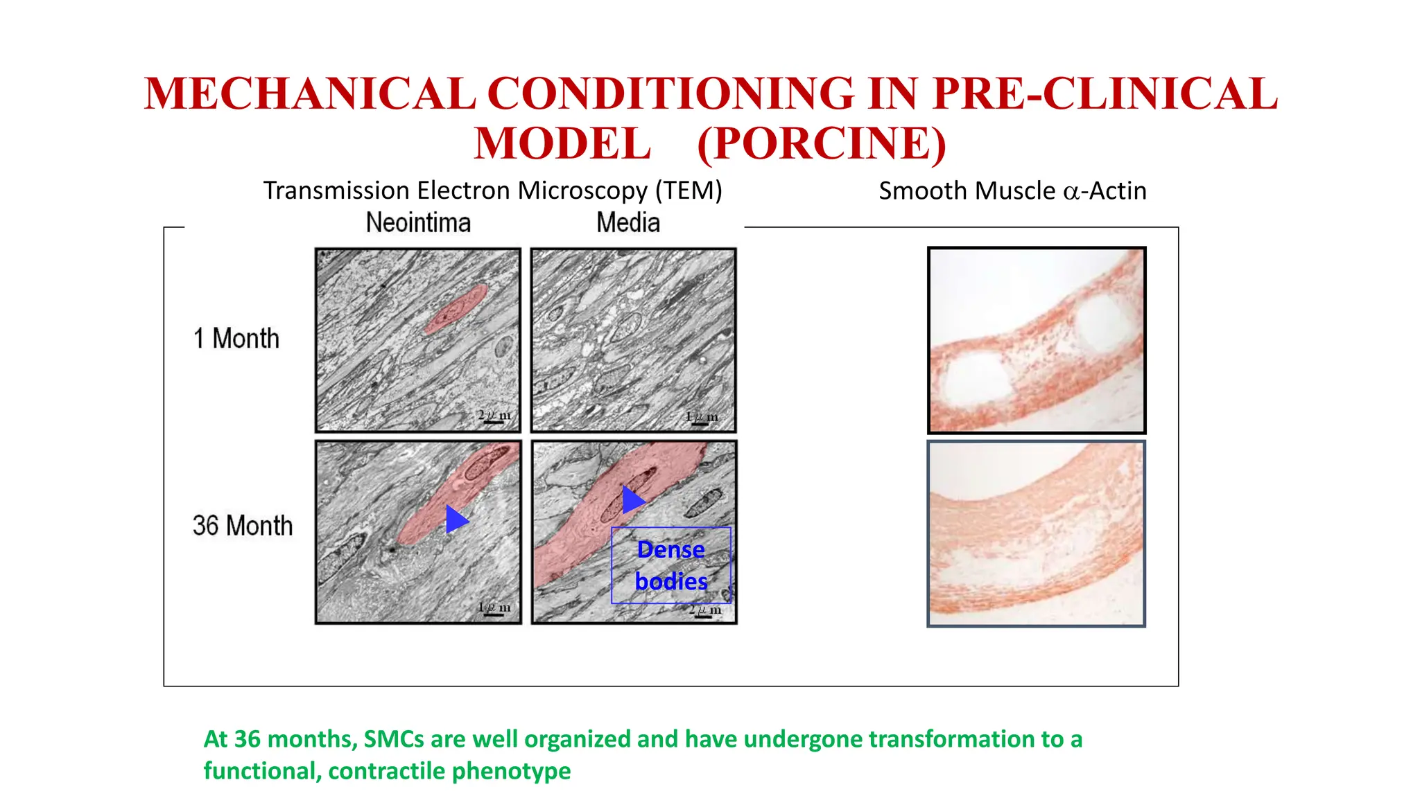Bioabsorbable Vascular Scaffold And Its Applicationold Pptx