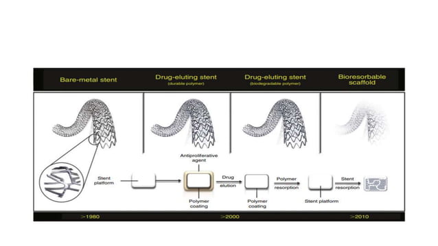 Bioabsorbable Vascular Scaffold And Its Applicationold Pptx