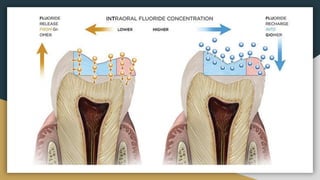 Bioactive materials Operative dentistry | PDF