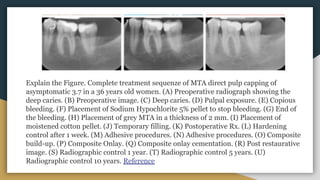 Bioactive materials Operative dentistry | PDF