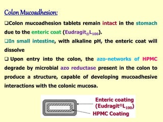 Bioadhesion Drug Delivery system | PPT