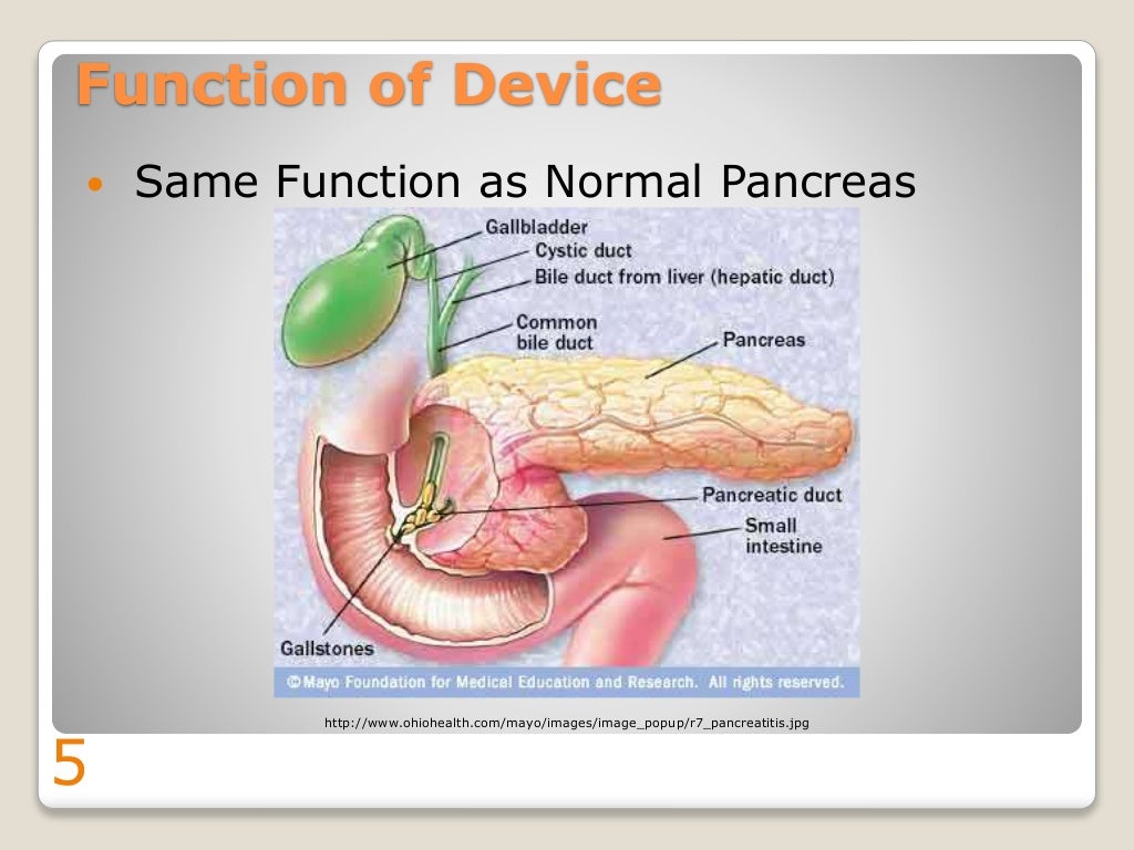 Bioartificial pancreas