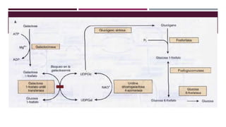 Fructosuria, galactosemia e intolerancia a lactosa | PPTX