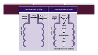 Fructosuria, galactosemia e intolerancia a lactosa | PPTX
