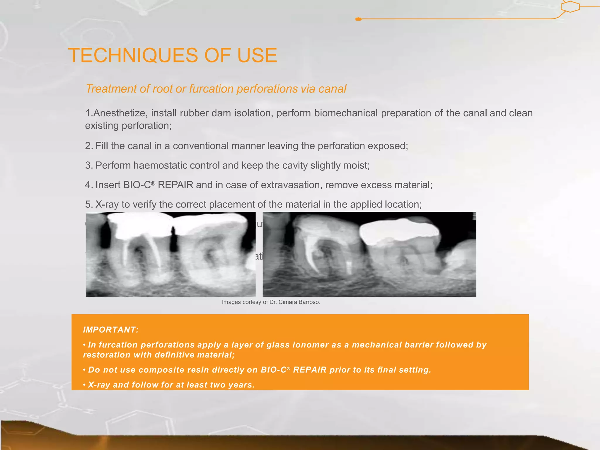 Bioceramics in dentistry.pptx