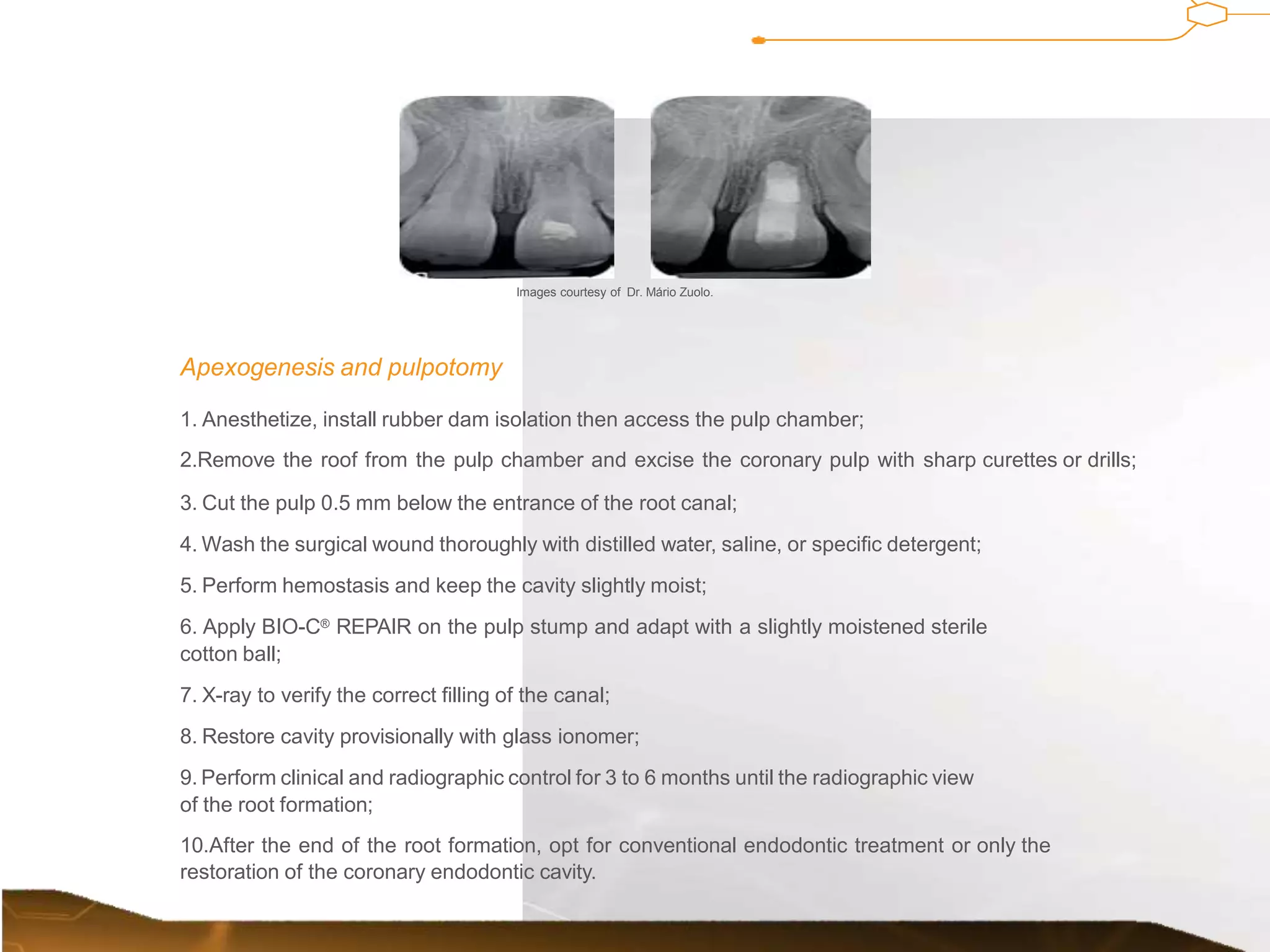 Bioceramics in dentistry.pptx