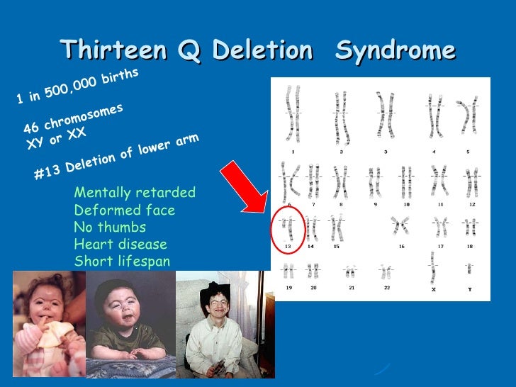 Q 22 Deletion Syndrome