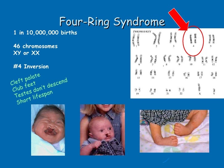 Inversion Mutation Diseases