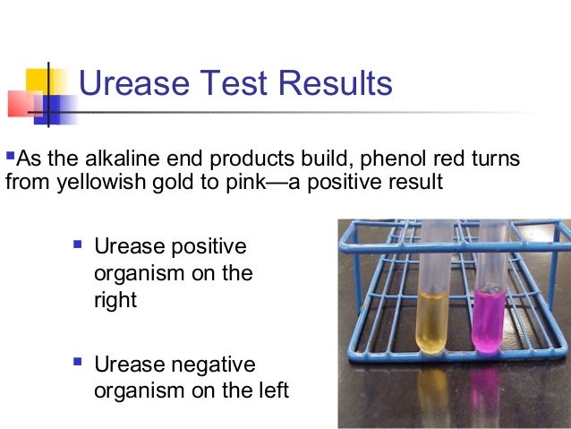 Urease Test For Pseudomonas Aeruginosa