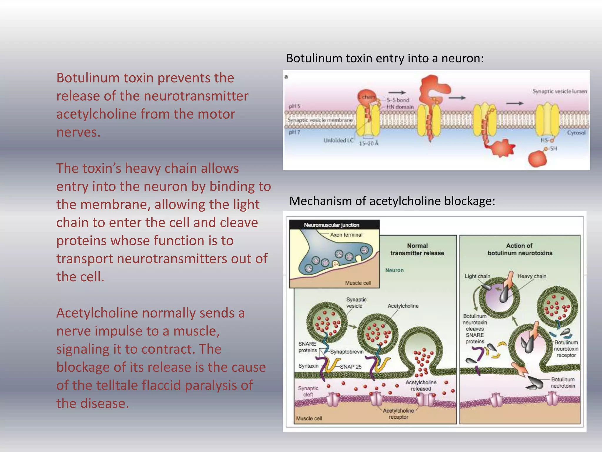 Case Study - Botulinum Toxin | PPTX | Brain and Nervous System ...