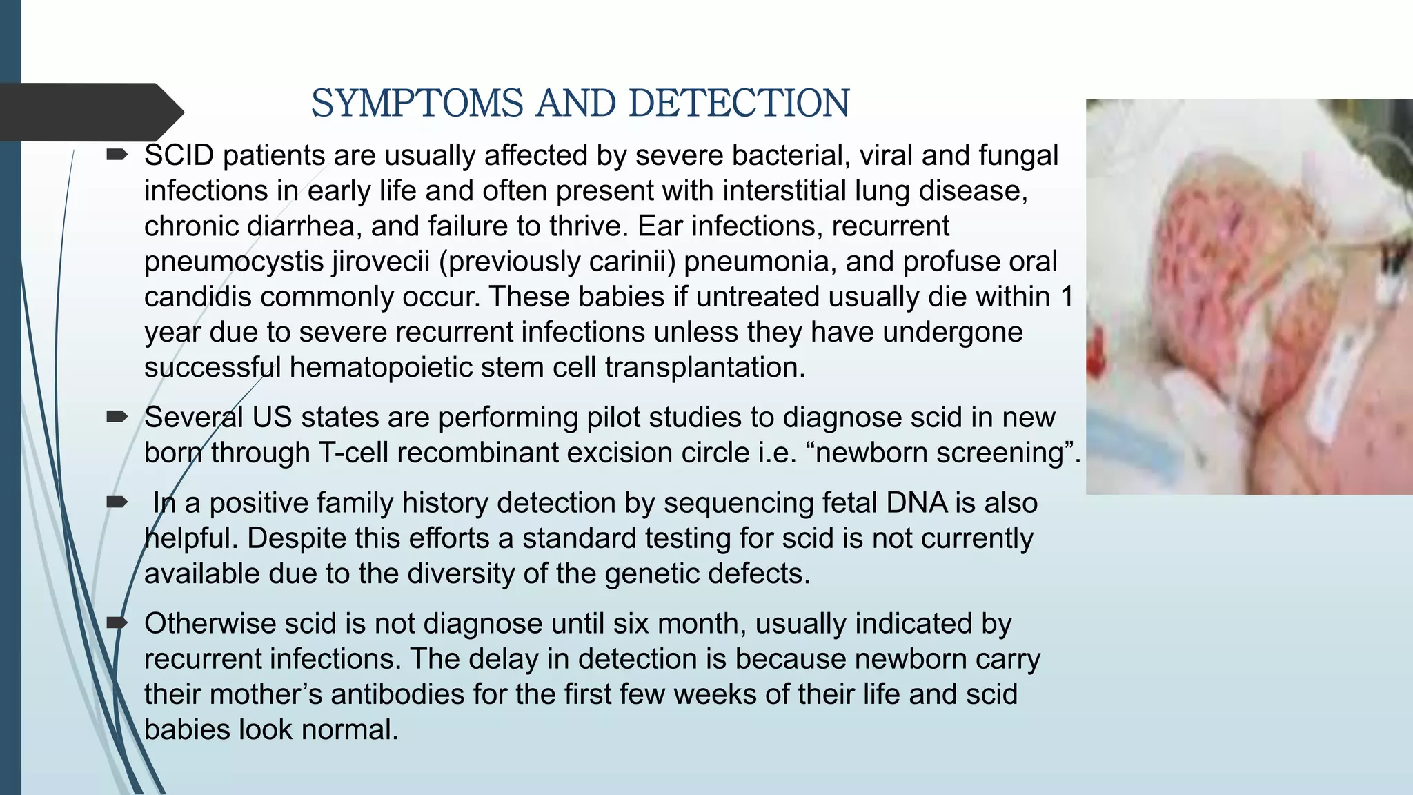 severe combined immunodeficiency syndrome | PPTX