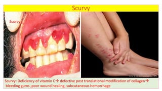 Biochemical and clinical aspects of collagen | PDF