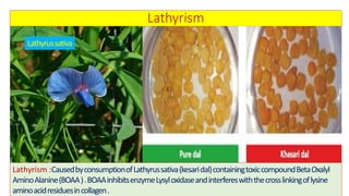 Biochemical and clinical aspects of collagen | PDF