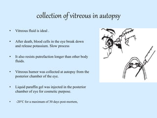 Biochemical changes of vitreous humour | PPTX