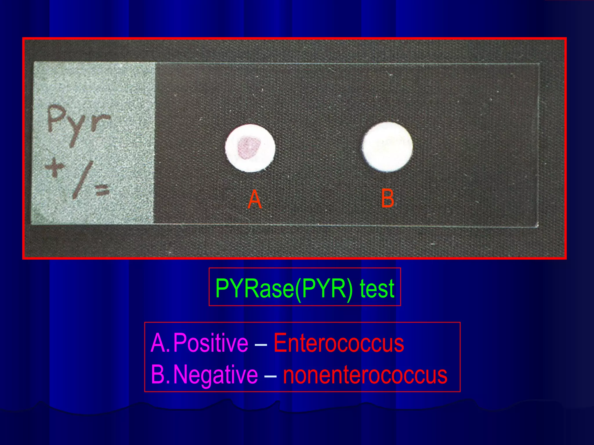 Biochemical identification of bacteria | PPT
