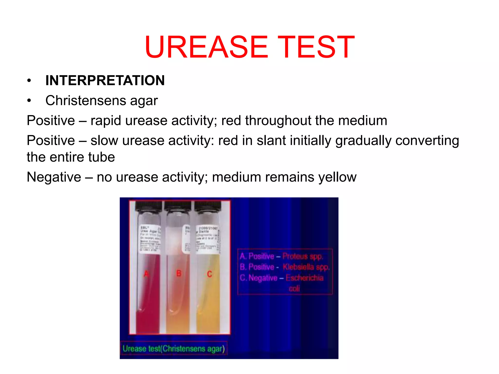 Biochemical Identification of bacteria 2023 sk.ppt | Blood Disorders ...