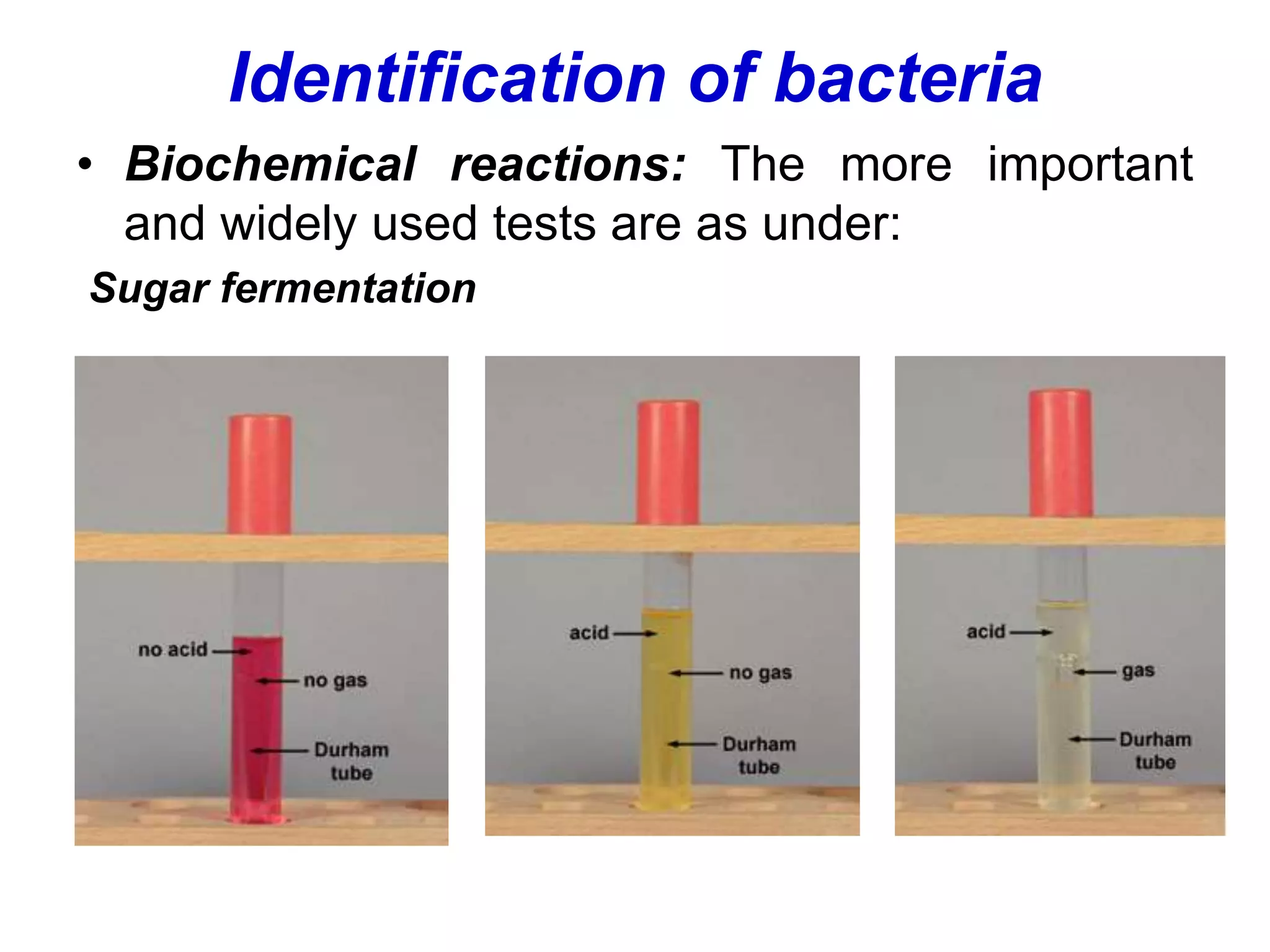 Biochemical Identification of bacteria 2023 sk.ppt | Blood Disorders ...