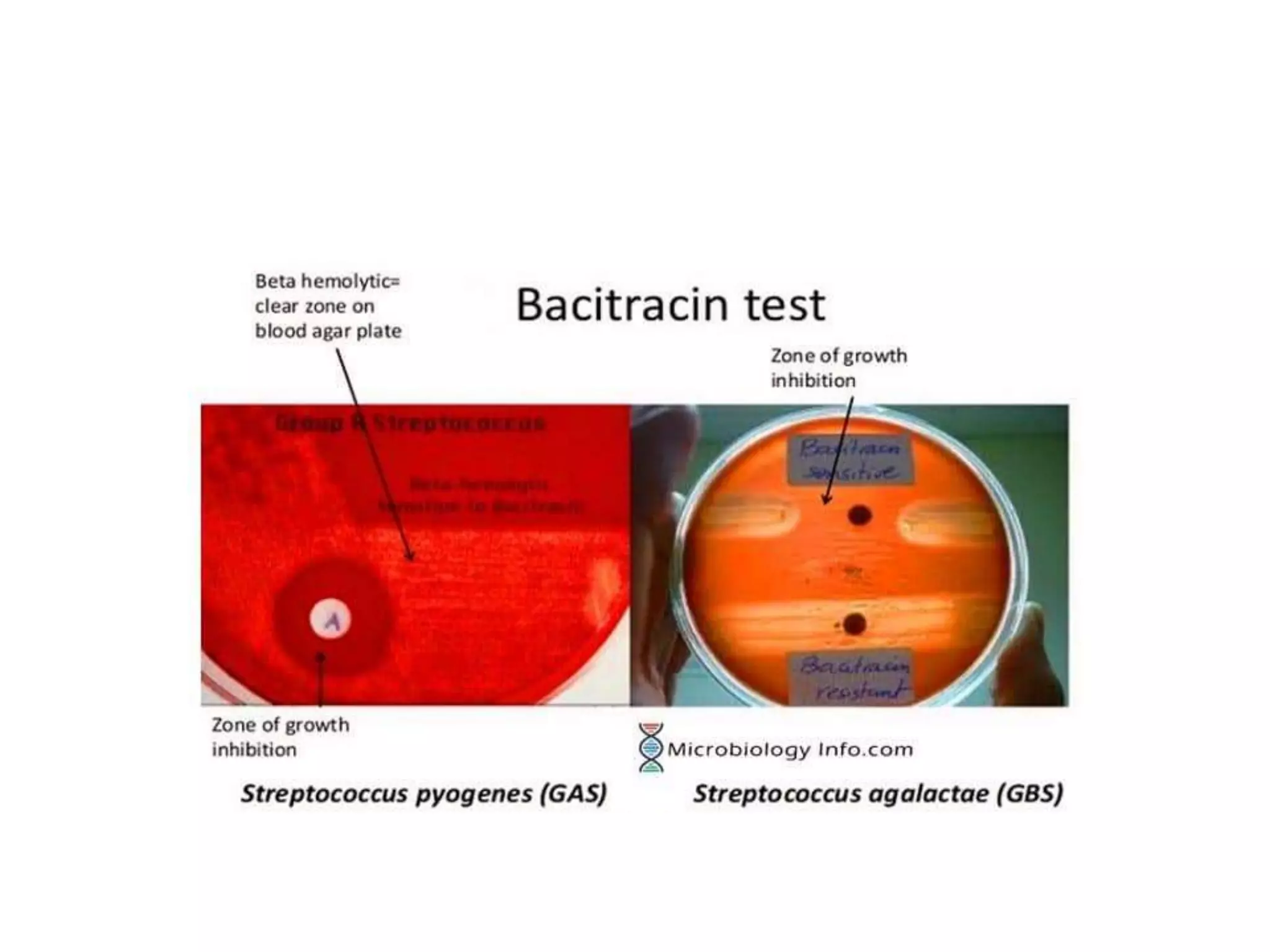 Biochemical Identification of bacteria 2023 sk.ppt | Blood Disorders ...
