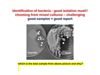 Biochemical Identification of bacteria 2023 sk.ppt | Blood Disorders ...