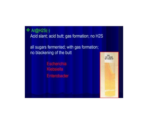 Biochemical Identification of bacteria 2023 sk.ppt | Blood Disorders ...