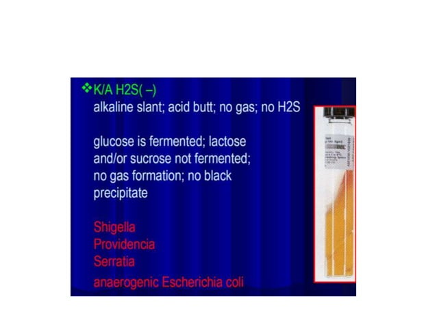 Biochemical Identification of bacteria 2023 sk.ppt | Blood Disorders ...