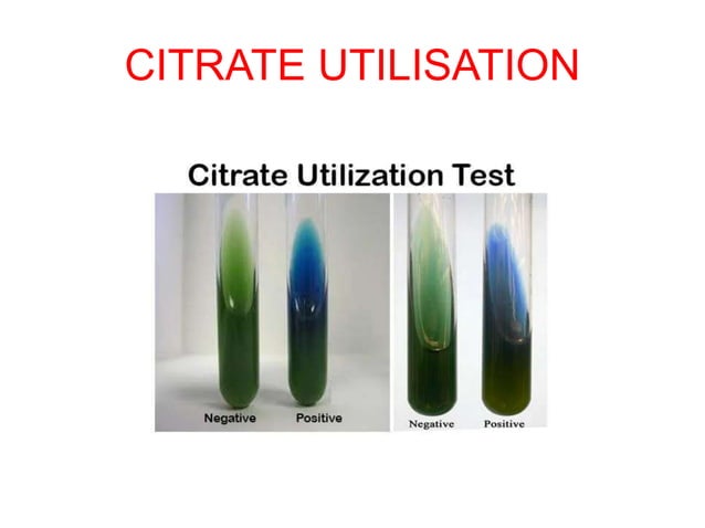 Biochemical Identification of bacteria 2023 sk.ppt | Blood Disorders ...