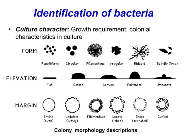Biochemical Identification of bacteria 2023 sk.ppt | Blood Disorders ...