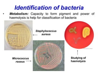 Biochemical Identification of bacteria 2023 sk.ppt | Blood Disorders ...