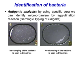 Biochemical Identification of bacteria 2023 sk.ppt | Blood Disorders ...