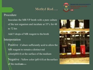 Biochemical test for identification of Bacteria | PPTX