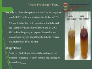 Biochemical test for identification of Bacteria | PPTX